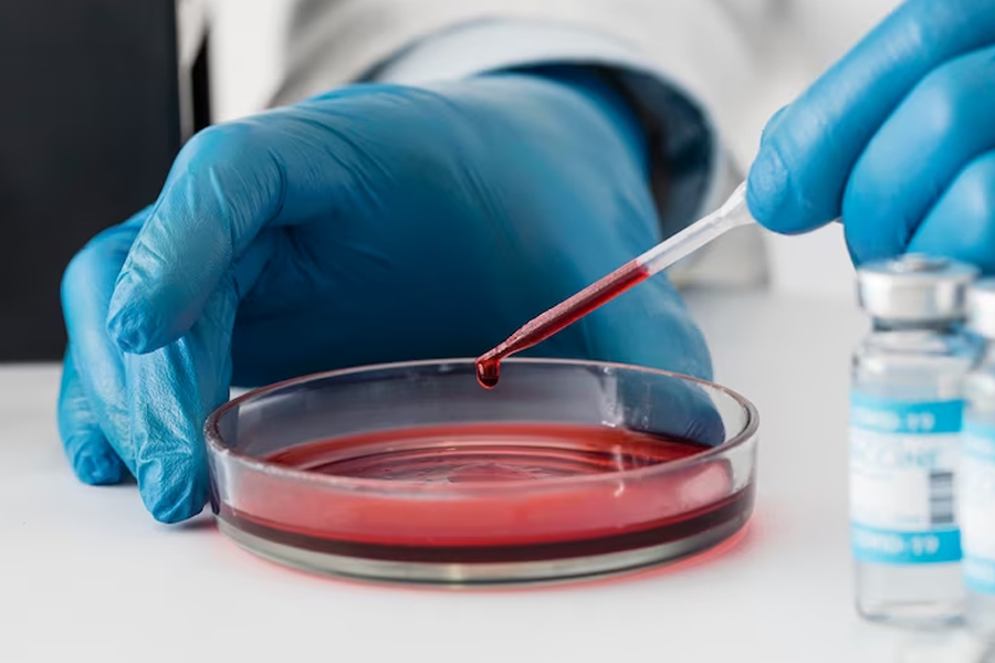 Exame de sangue: entenda o caminho desde o pedido médico até o ...